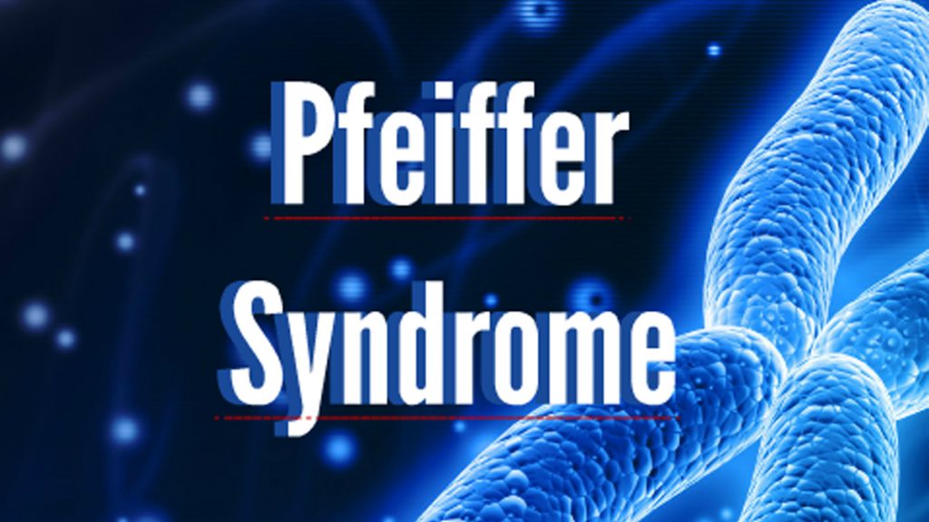 Parents seek donation for son with Pfeiffer Syndrome